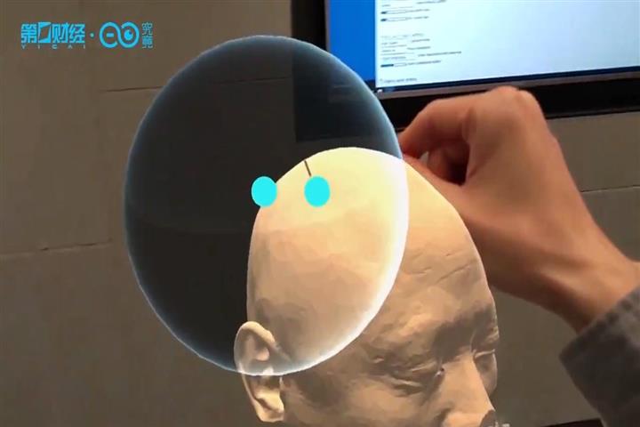 AR-Based Surgical Navigation System From MiDIVI Which Will be Showcased ...