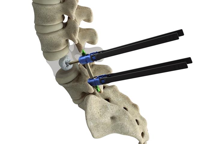 Medical Devices Maker Sanyou Gets China Distribution Rights for CGBio’s ...